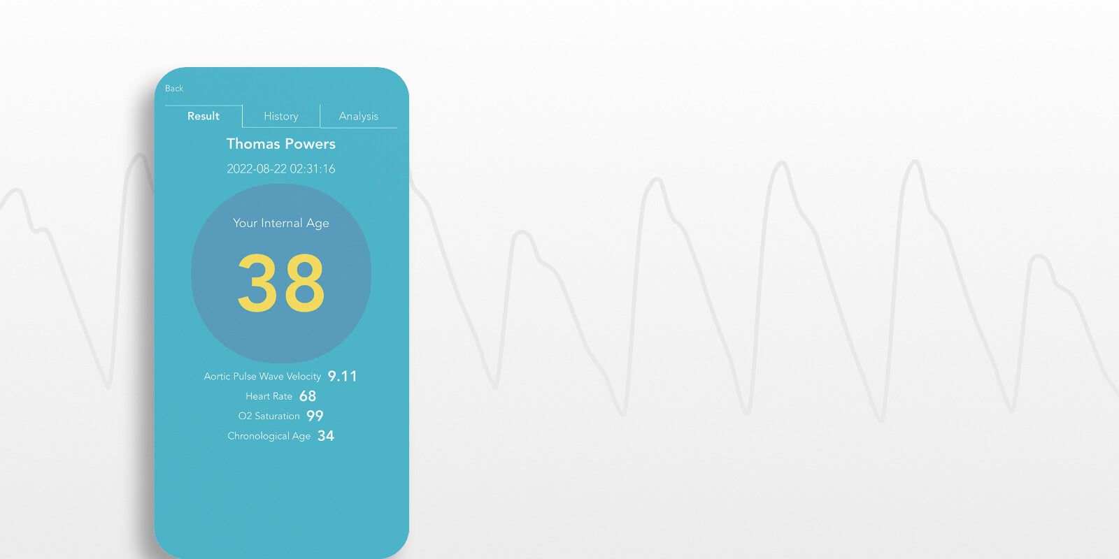 iheart Internal Age – iHeart